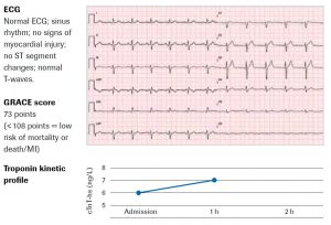 Early Triage of Acute Chest Pain with hs-TnT Algorithm