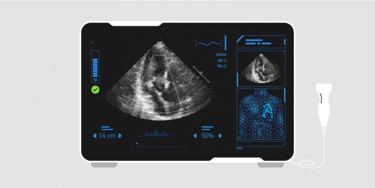Setting sight on breakthrough diagnostics - Cardio ThinkLab